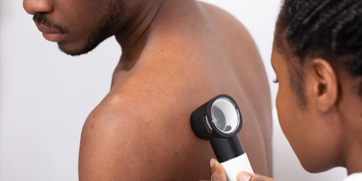 Black Men and Skin Cancer: A Hidden Health Crisis - Dallas Weekly